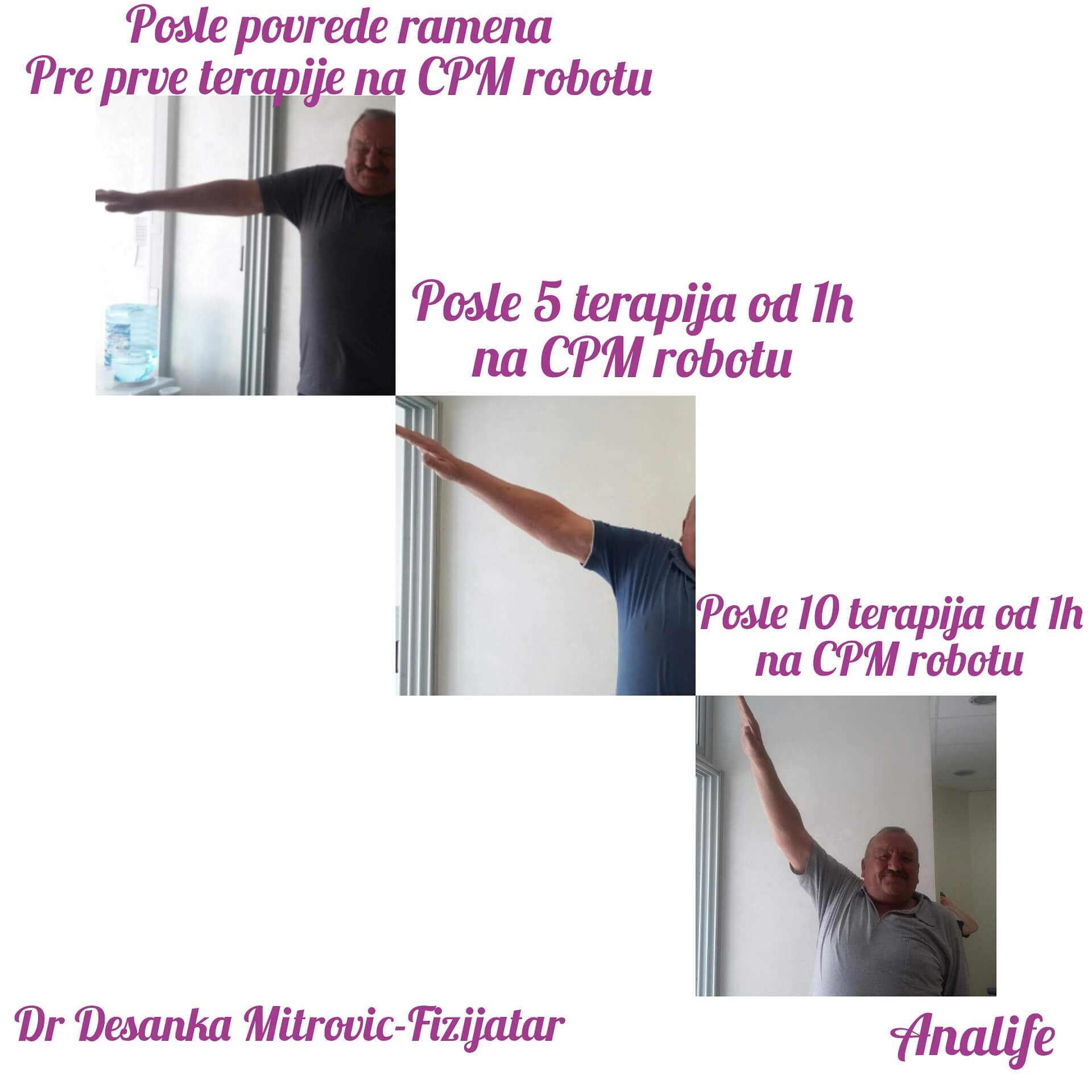 Kako postići pun obim pokreta posle povrede ramena? - Opšta Bolnica Analife