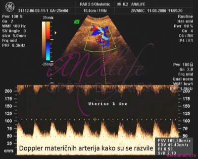 4D ultrazvuk - Ekspertski UZ od 11-13. nedelje trudnoće
